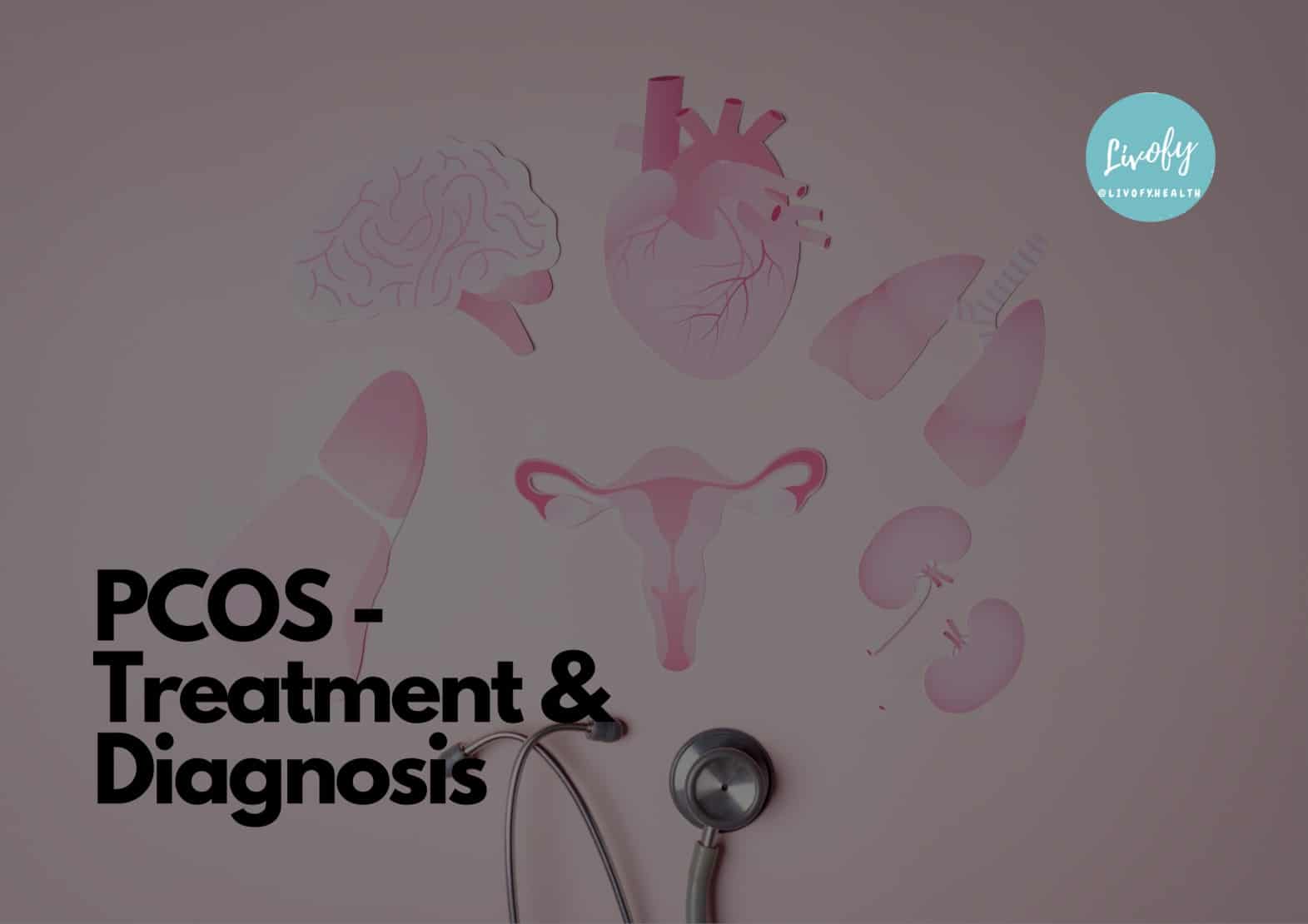 Polycystic Ovary Syndrome: PCOS Treatment & Diagnosis | Livofy